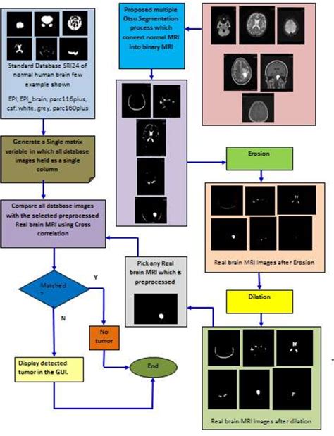 Figure 1 From Brain Tumor Recognition From Mri Images Using Multiple