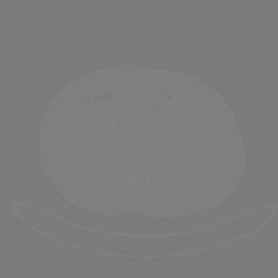 DeepLesion Dataset Ninja