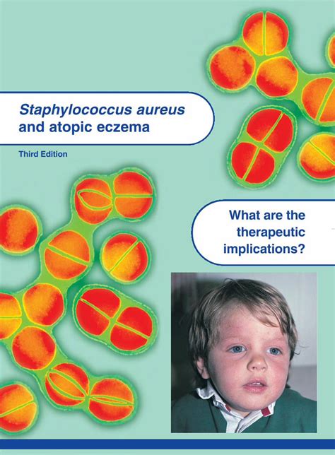 Pdf Staphylococcus Aureus And Atopic Eczema · 2019 02 08 · With Staphylococcus Aureus Showed