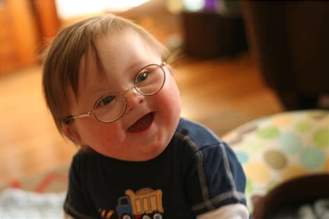 همه چیز راجع به سندرم داون