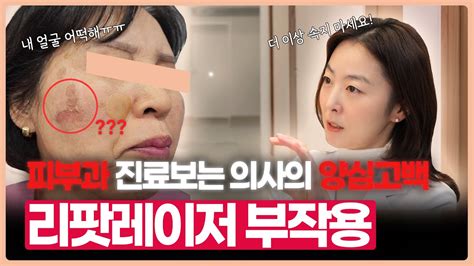 리팟 레이저 부작용 진료과목 피부과 의사가 양심 고백합니다 흑자 치료 부작용에 대한 모든 것 Youtube