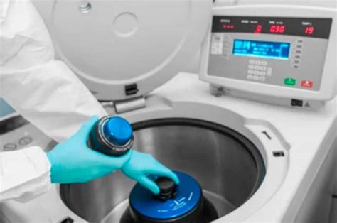 Medical Electronics Manufacturing Services VEXOS