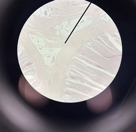 Physio Lab Practical Flashcards Quizlet