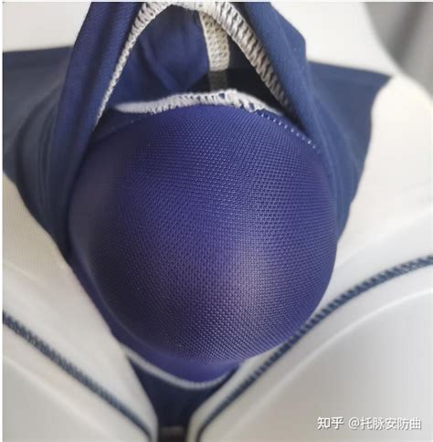 得了精索静脉曲张轻度可以自愈吗 知乎