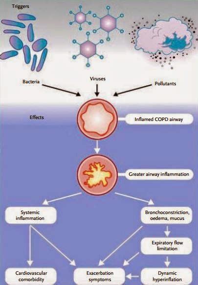 COPD Exacerbation Definition Assessment Management