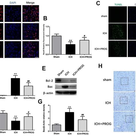 Effect Of Progesterone On Neuron Death And Cell Apoptosis A Download Scientific Diagram