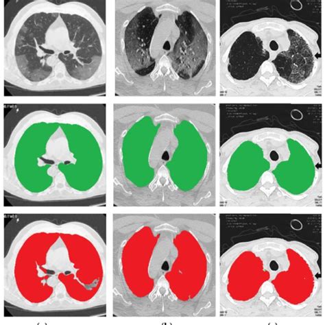 visual lung segmentation comparison a axial slice b ground truth download scientific