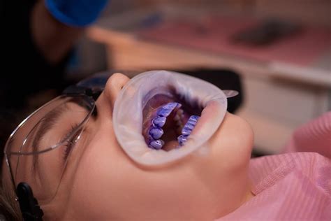 Premium Photo Plaque Indicator On Human Teeth With Braces Plaque Is