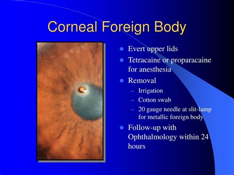 Ppt Primary Care For The Red Eye Powerpoint Presentation Free