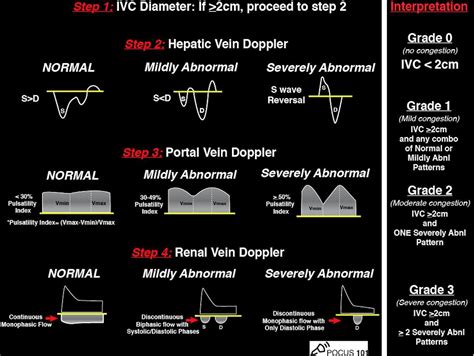 Assessing Left Ventricular Ejection Fraction With Echocardiography