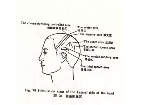 Scalp Acupuncture Pdf