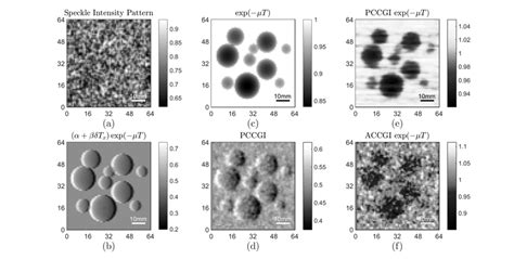 Comparison Of X Ray Phase Contrast And Absorption Contrast Download Scientific Diagram