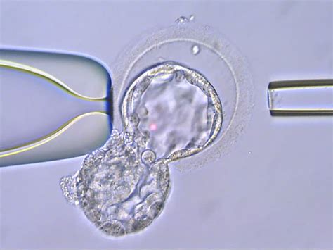 Ahmad Awartani On Linkedin Trophectoderm Biopsy Using The Flick Method When The Icm Inner Cell