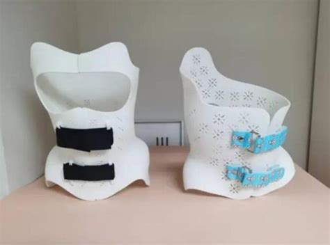 上海同仁医院骨科门诊开启3d打印支具服务 3d科学谷