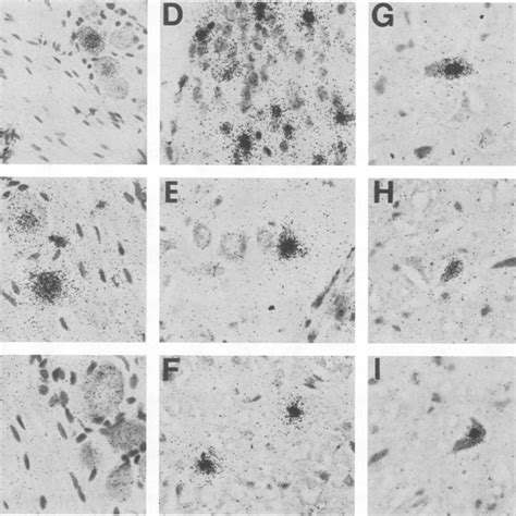 Hsv 1 Rna Localization During Acute Infection Of The Trigeminal Ganglia