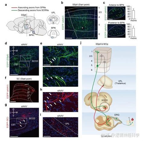 Cell Research︱广东省智能院张旭研究团队发现一条传导痛觉的脊髓 皮层直接通路 知乎