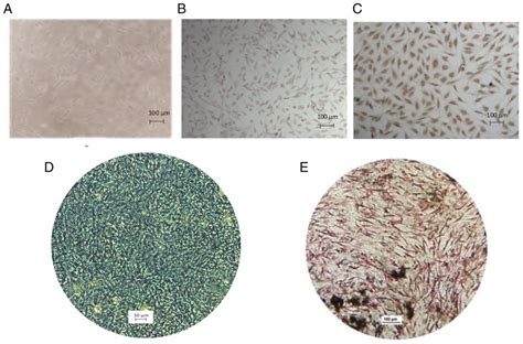 Bm Mscs Characterization A Bm Mscs Were Adherent To The Culture Download Scientific Diagram