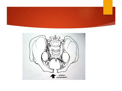 Pelvic Fracture Ppt By Dr Bharti Pawar Ppt