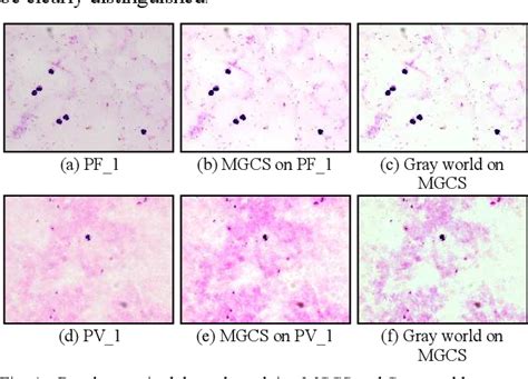 Figure 4 From A Robust Segmentation Of Malaria Parasites Detection Using Fast K Means And