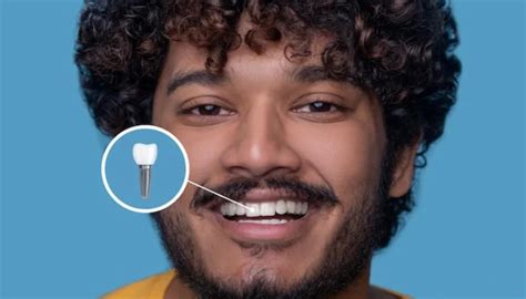 بلاگ مکس دنتال