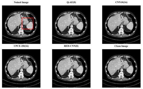 Comparison Of Different Deep Learning Methods For Low Dose Ct Images Download Scientific