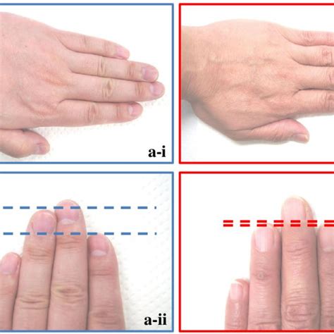 Relationship Between The Difference In Ring And Index Finger Lengths