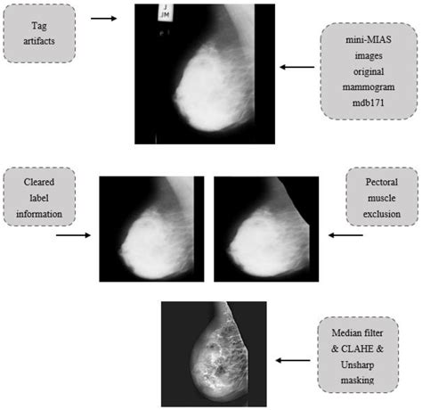 Diagnostics Free Full Text A Novel Medical Image Enhancement