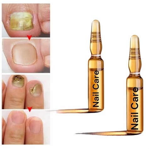 Nail Serum Strong Nail Serum Growth Nail Fungus Cream Nail Repair