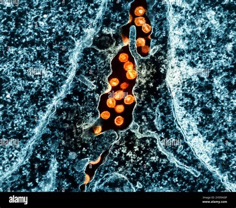 Colorized Transmission Electron Micrograph Of Hiv 1 Virus Particles Orange Budding And