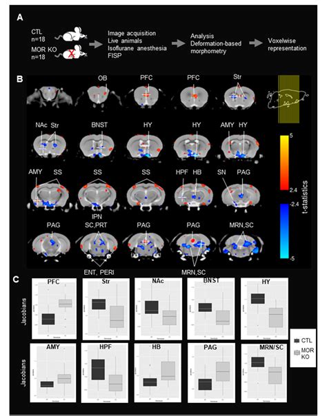 Figure 1 From Deformation Based Morphometry Mri Reveals Brain Structural Modifications In Living
