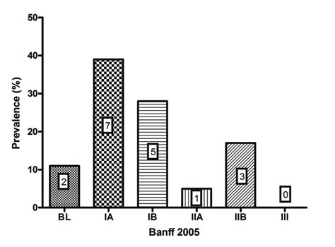 Acute Cellular Rejection Types According To Histological Classification