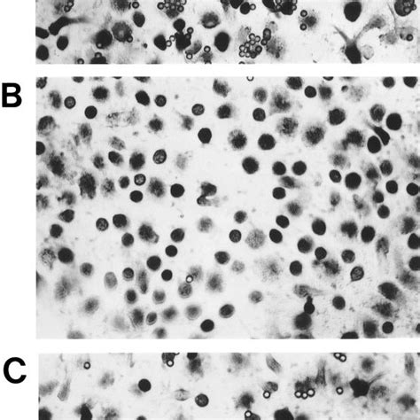 Fibronectin Bead Binding Is Reduced When T Cells Adhere To Icam 1