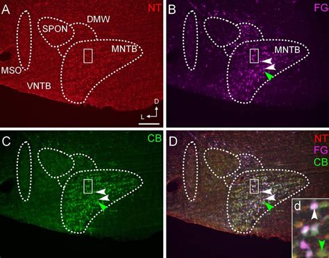 Mntb Neurons Projecting To The Thalamus Are Cb Shown In A Through D
