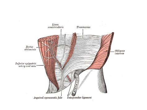 Surgical Anatomy Of Inguinal Hernia