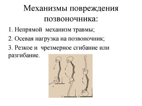 Травма позвоночника презентация онлайн