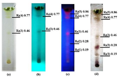 Tlc Chromatograms Of N Butanol Fraction From Tlc Using Mobile Phase