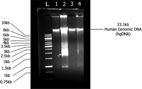 Effect Of Uva On Dna Fragmentation Of Bj Fibroblast Cells Lane 1