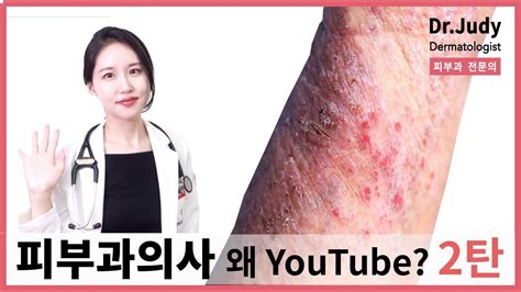 피부과의사가 유튜브를 시작한 이유 2탄 L 습진 아토피피부염 건성 민감성 피부라서 Youtube