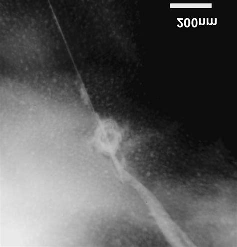 Tem Image Of Twin Boundary Observed In Low Magniˆca Tion Download Scientific Diagram