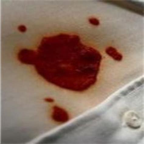 Corrosion Detection 1 Classification Model By Corrosion Detection Sd