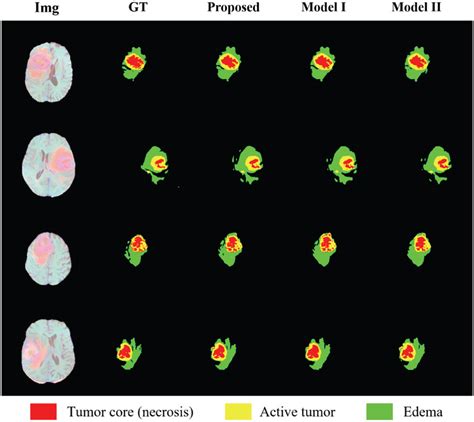 Figure 8 From A Deep Multi Task Learning Framework For Brain Tumor