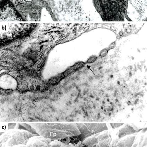 Electron Micrographs Of A Tonsillar Crypt Epithelium A Scanning