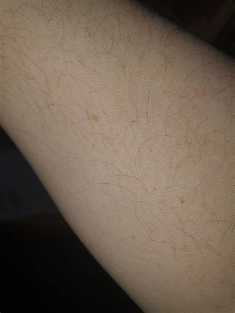 Красные точки на руках User 29424001 Ответы Mail