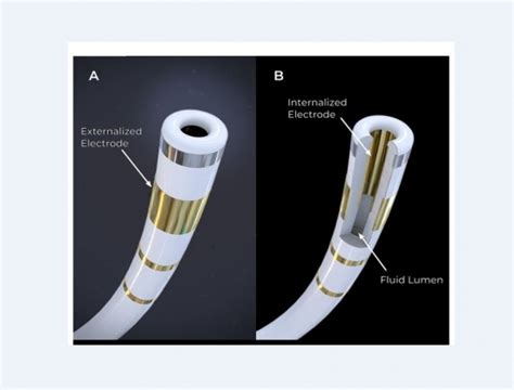 Field Medical Announces First In Human Trials For Groundbreaking Fieldforce Ventricular Pulsed