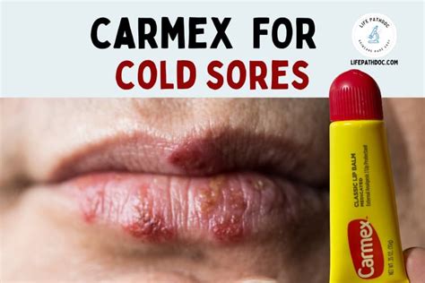 Can Carmex Help Heal Your Cold Sore