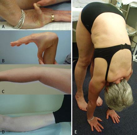Pin On Fitnessforeveryone