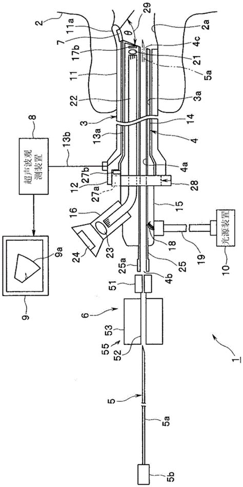 Treatment Instrument Insertion Aids Eureka Patsnap
