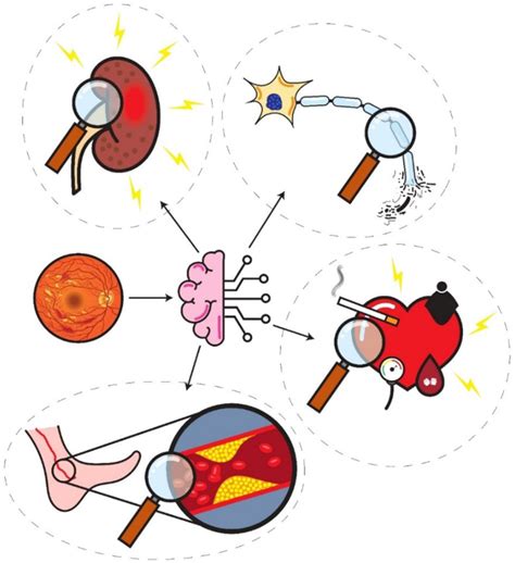 Artificial Intelligence For Early Detection Of Diabetes Mellitus Complications Via Retinal