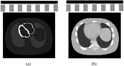 Figure 1 From Validation Of Convolution Based Forced Detection Simind With Analytical Collimator
