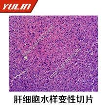 正常肝脏组织切片图解 图库 五毛网